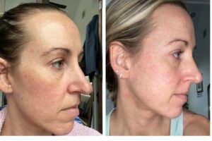 OneSkin OS-01 Brand Review - wizardingbeauty.com